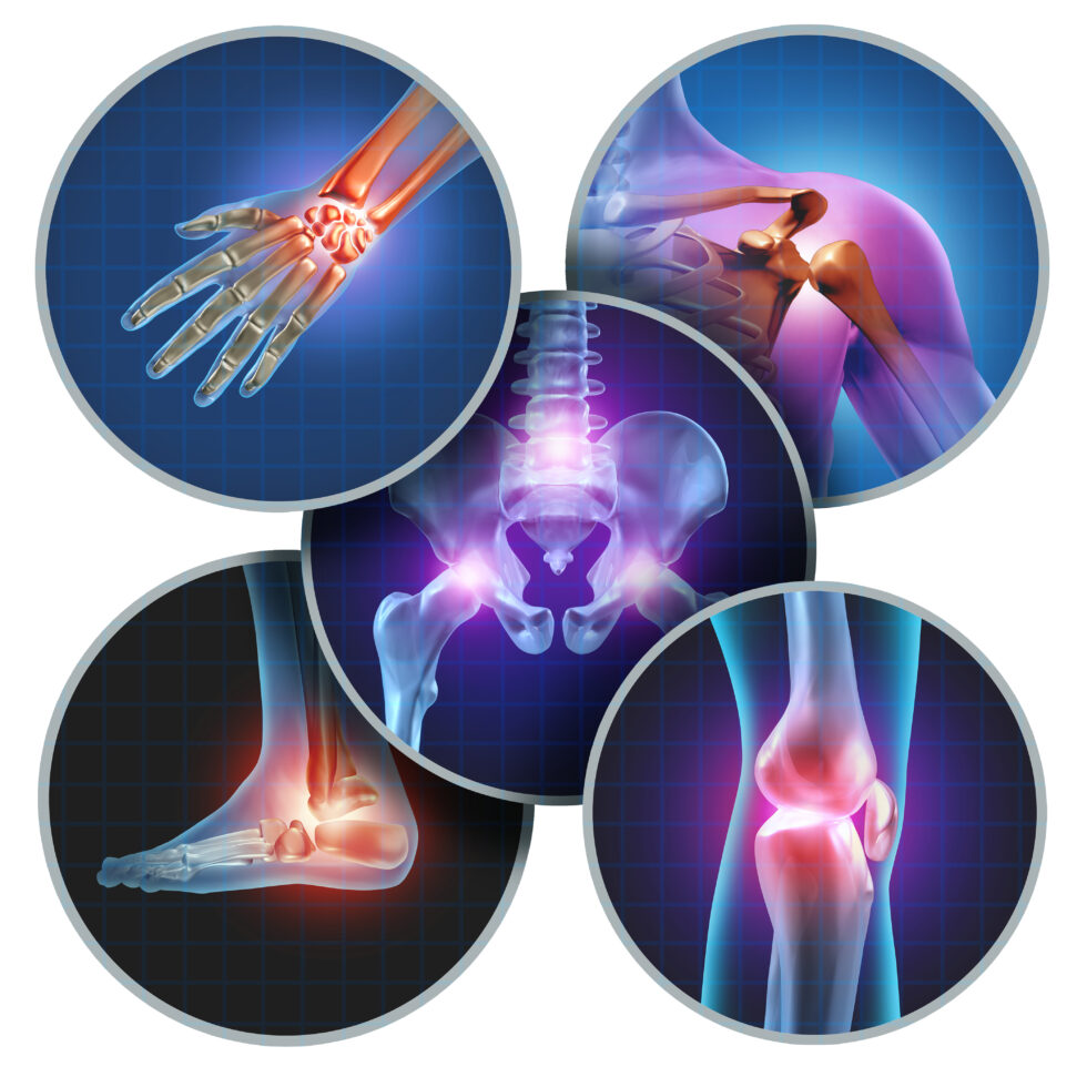 Sports Injuries | Pacific Sports & Spine